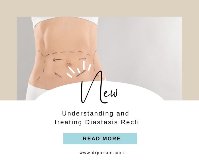 Understanding Diastasis Recti | Dr. Shaun Parson, Scottsdale