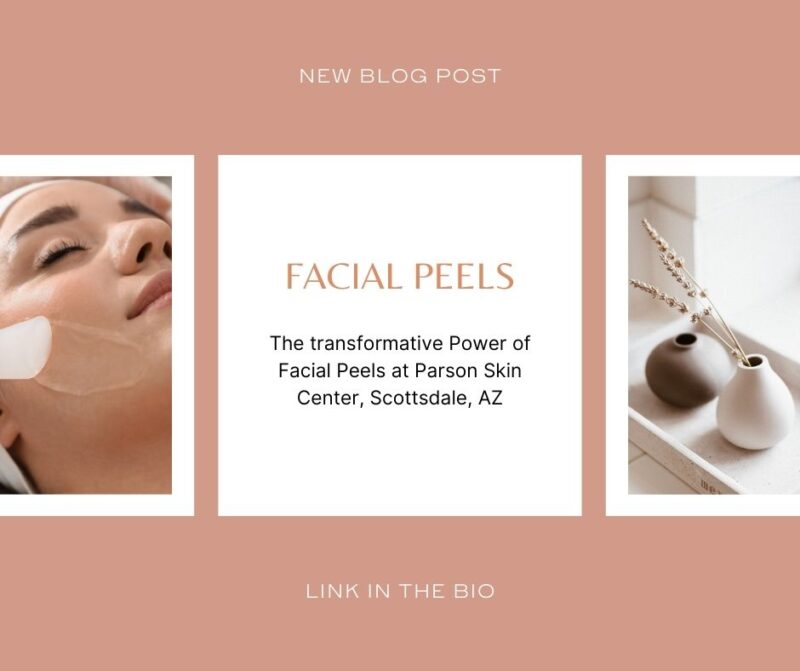 Transformative Power of Facial Peels | Parson Skin Center, AZ